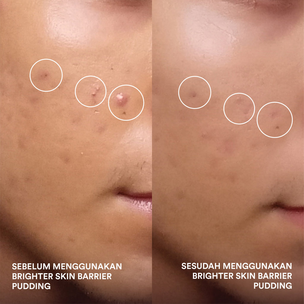 Brighter Skin Barrier Pudding – Studio Tropik